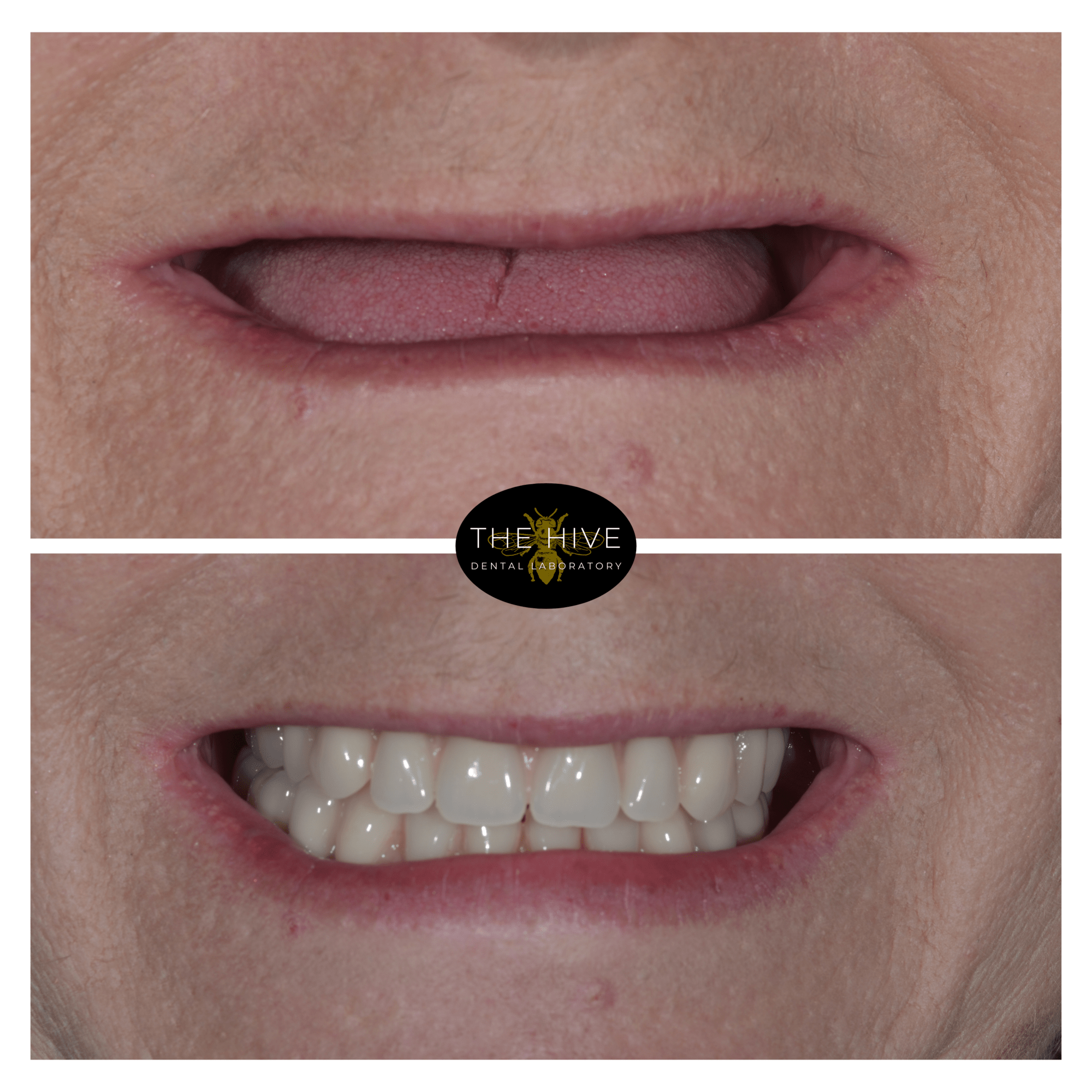 The Hive Dental Laboratory Medical And Dental Laboratories In